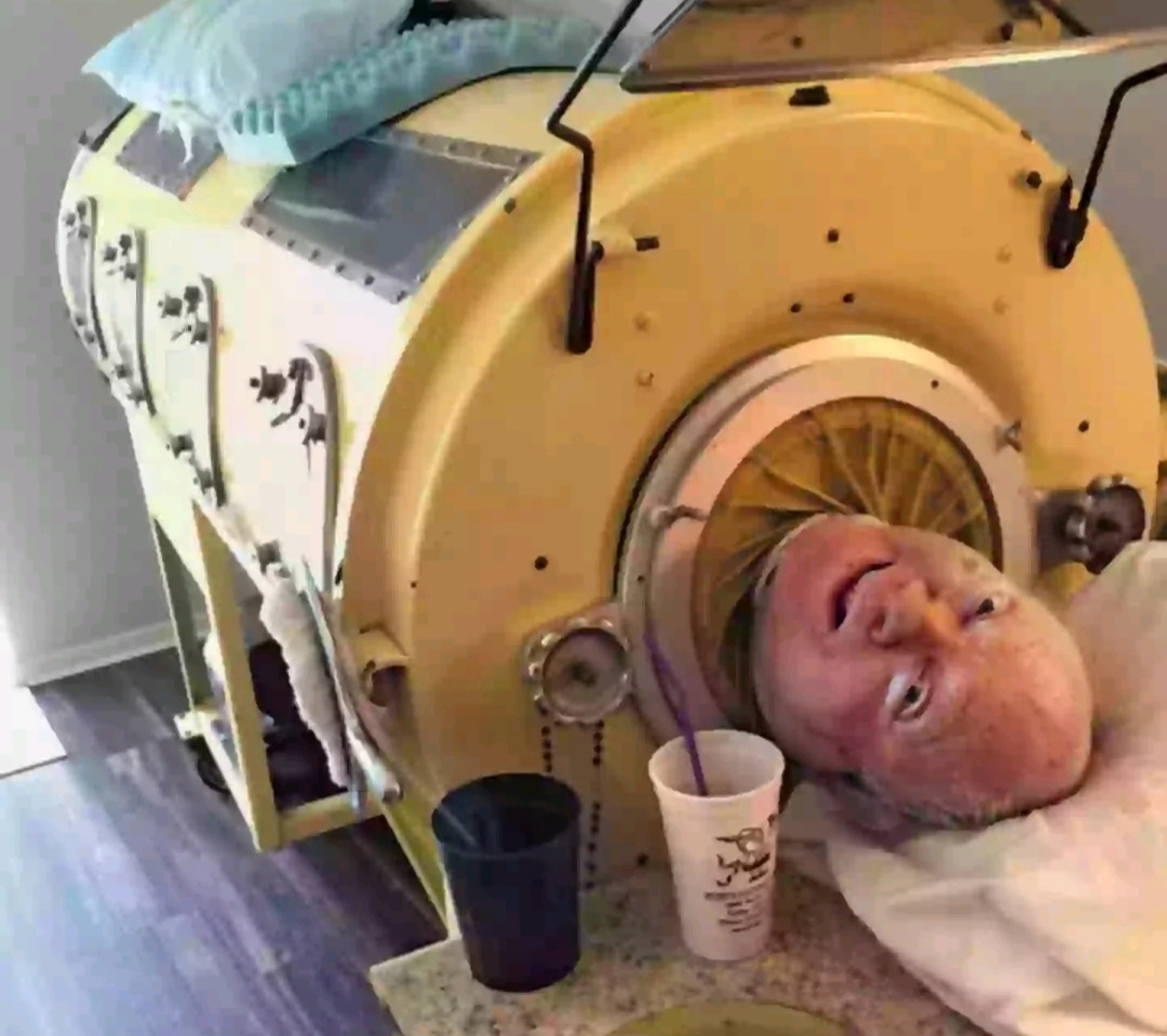 Man who lived in iron lung for 70 years until his death answered hugely ...