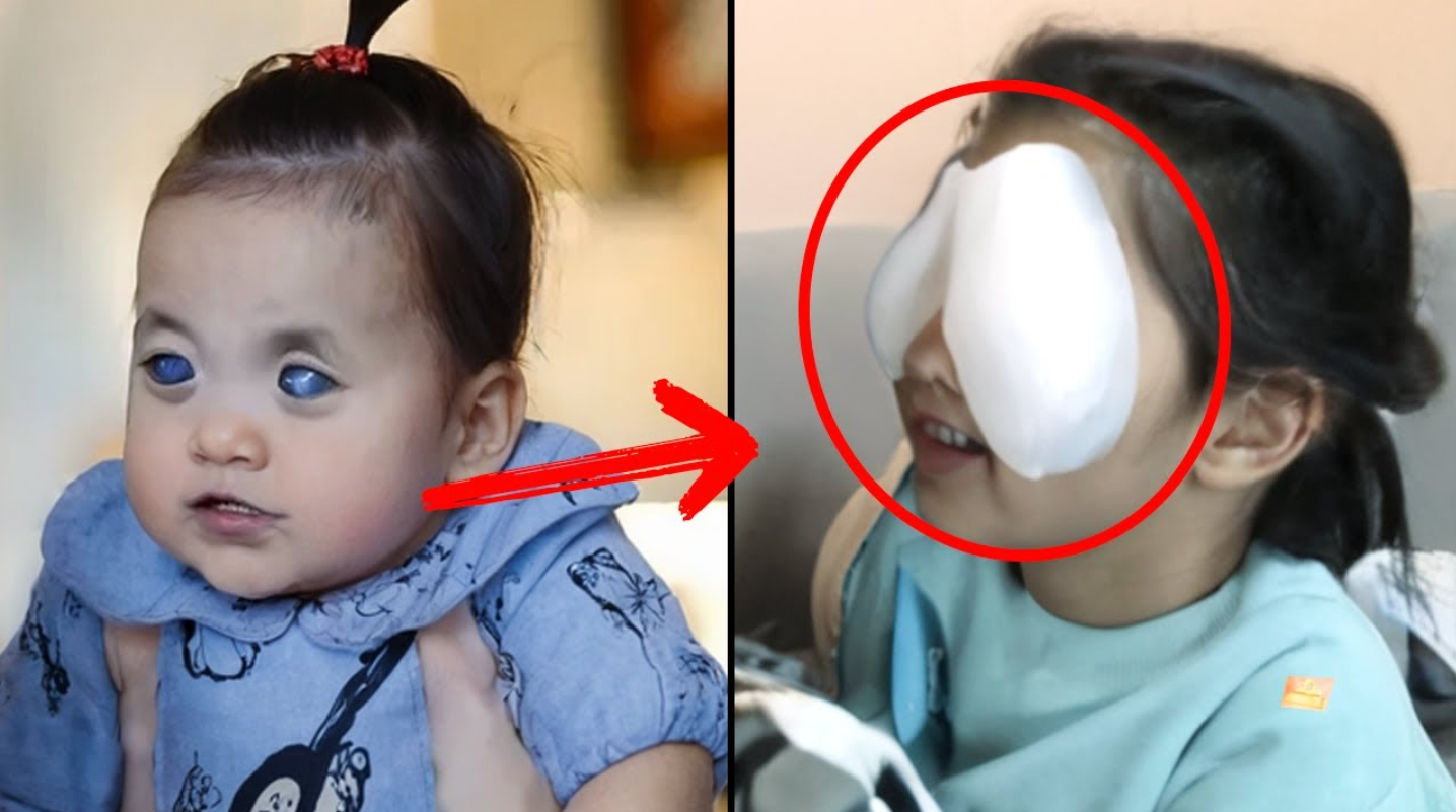She Was Abandoned by Her Mother Because of Her Eyes. Then a True ...